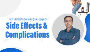Post Hemorrhoidectomy (Piles Surgery): Side Effects & Complications